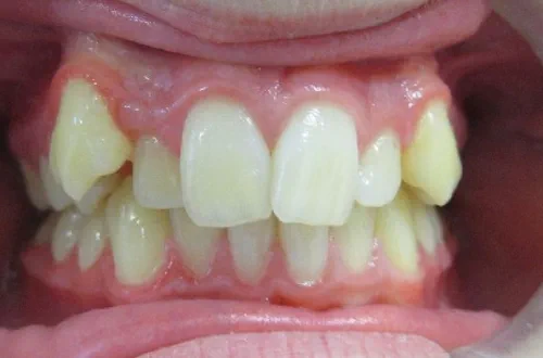 Total Orthodontics Macclesfield | Specialist Orthodontist